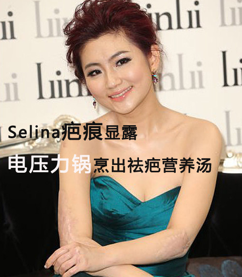 Selina疤痕显露 电压力锅烹出祛疤营养汤_天极网